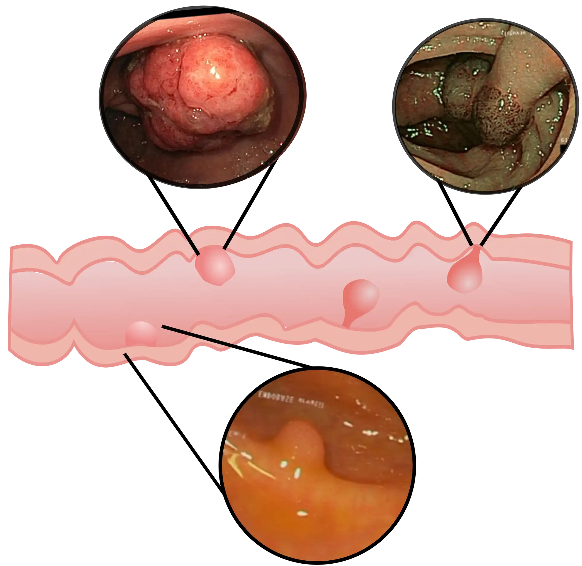 Project COLONAiVE™ - SCOPED IN TIME SAVED IN TIME